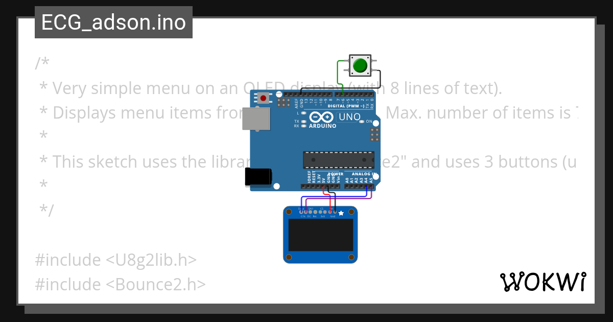 ECG_adson.ino - Wokwi ESP32, STM32, Arduino Simulator