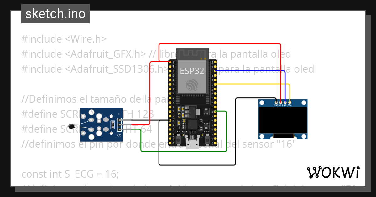 pantalla_oled - Wokwi ESP32, STM32, Arduino Simulator
