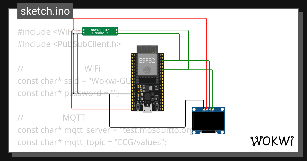 ECG_NodeRed - Wokwi ESP32, STM32, Arduino Simulator