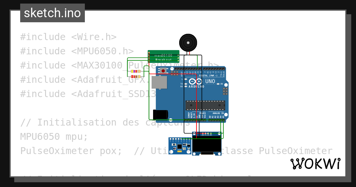 Epilecticdetector Wokwi Esp32 Stm32 Arduino Simulator 8956